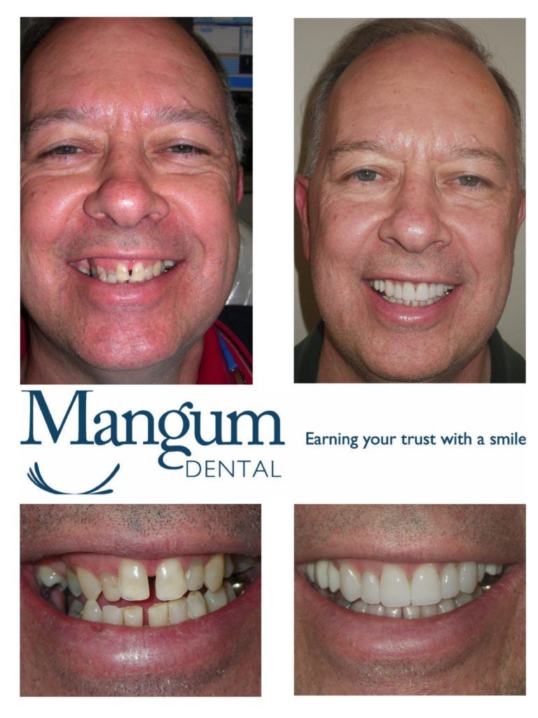 April 2017 Mangum Dental Mouth of the Month » Prescott, AZ | Mangum Dental